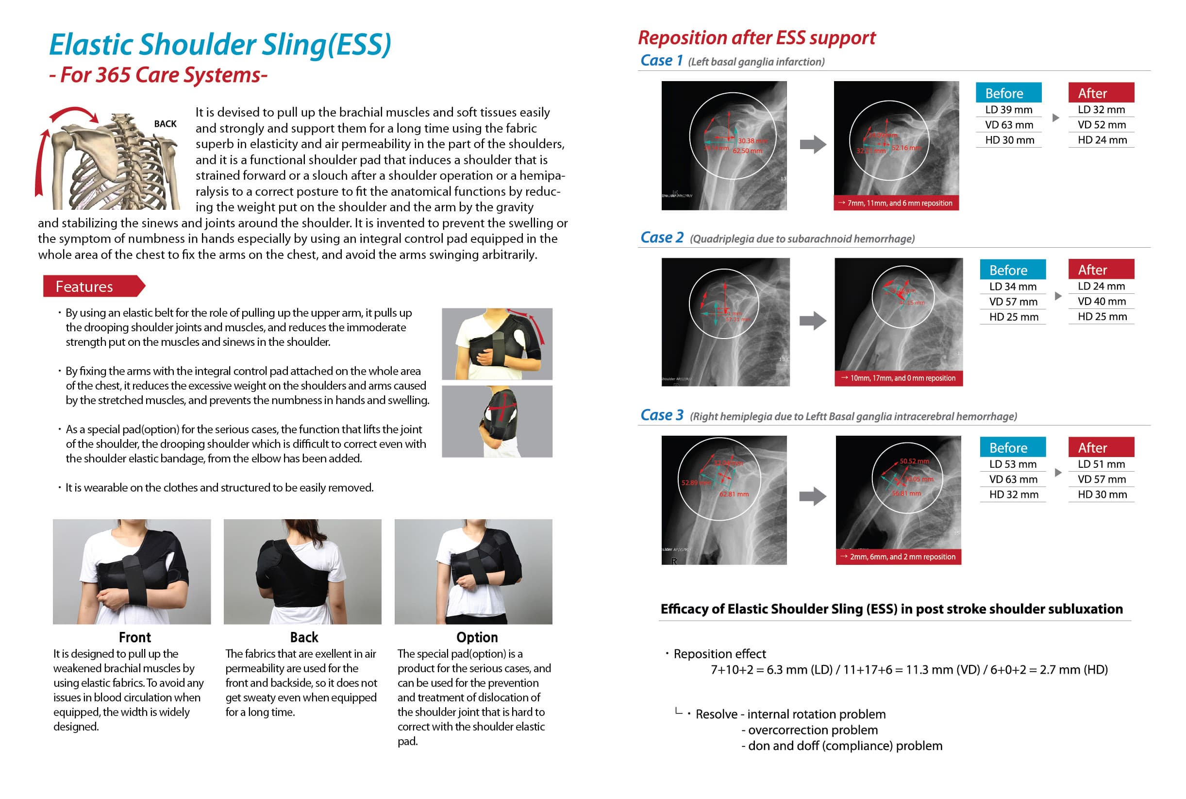 Elastic Shoulder Sling (E.S.S) for 365 systems | tradekorea