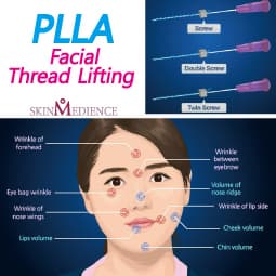 PLLA thread lifting | tradekorea