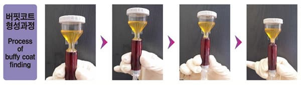 I-STEM (Y-STEM) PRP KIT | tradekorea