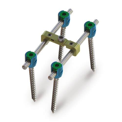 MEGAFIX® (Spinal Fixation System) | tradekorea
