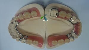 Partial/Full Dentsply pink acrylic denture, Lucitone 199 acr | tradekorea