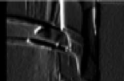 Fine Particle Vision System(FPVS) | tradekorea