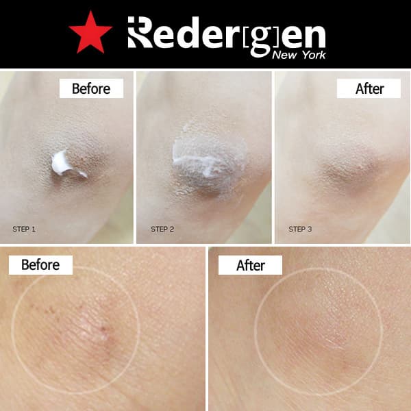 [Redergen] Knee + Elbow Brightening Cream, Dead Cell, Bleach | tradekorea
